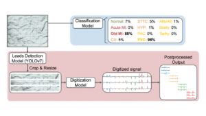 Dual Deep Learning System to Digitize and Classify 12-lead ECGs from Scanned Images - Inventec ...
