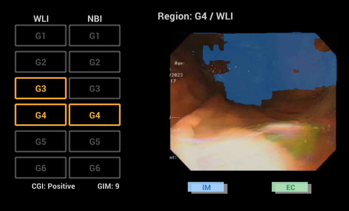 英胃筛 I-GASP - Inventec AI Center